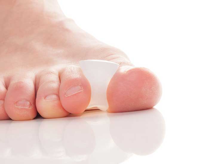 Orthoplastie Béthune - Orthèse d'orteil, hallux valgus